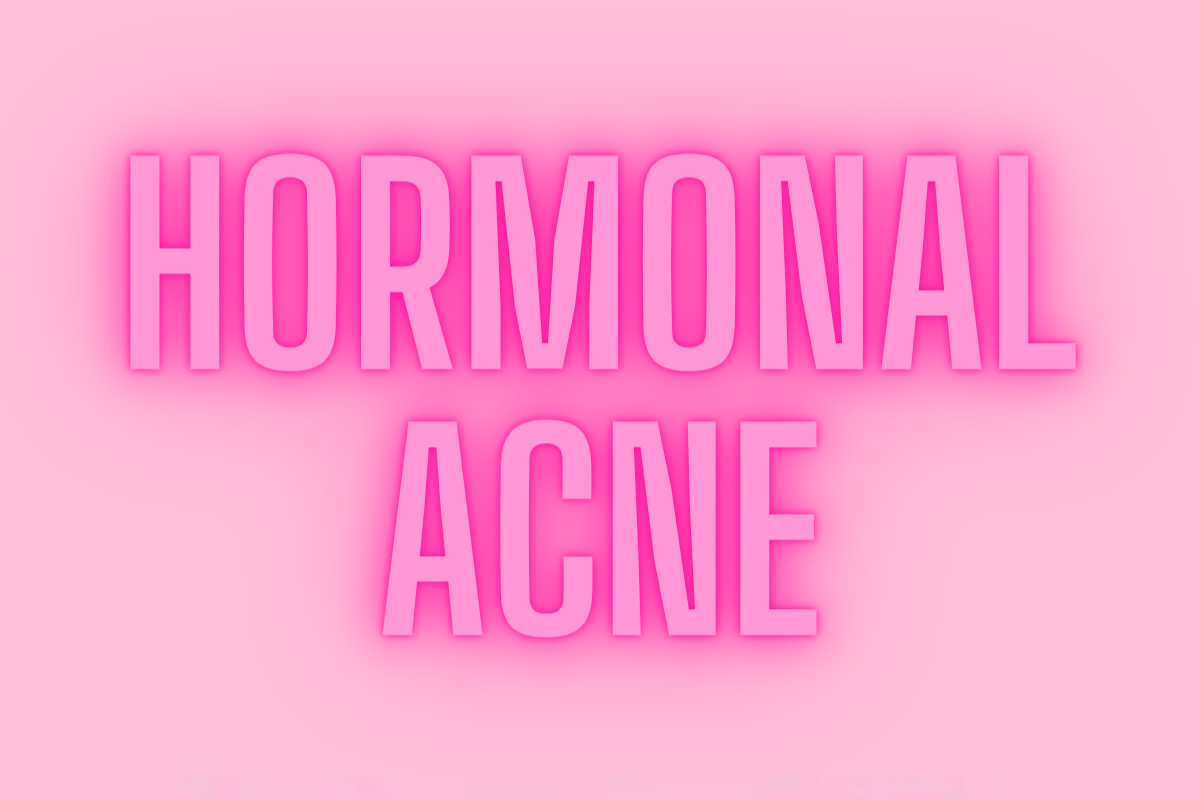 5 Tips To Clear Hormonal Acne Real U